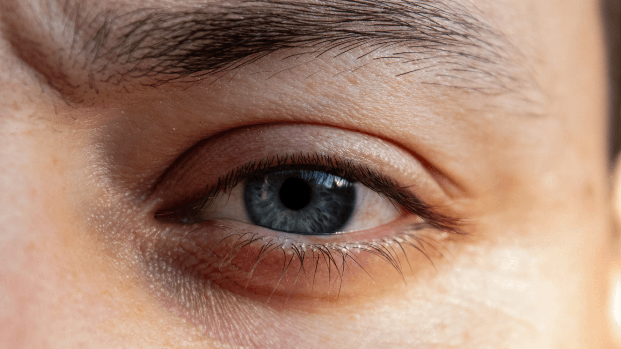 Edema en un ojo: causas, sintomas y tratamientos efectivos