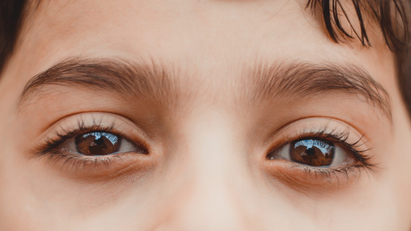 Anisocoria: qué es, causas y cuándo preocuparse por estrés