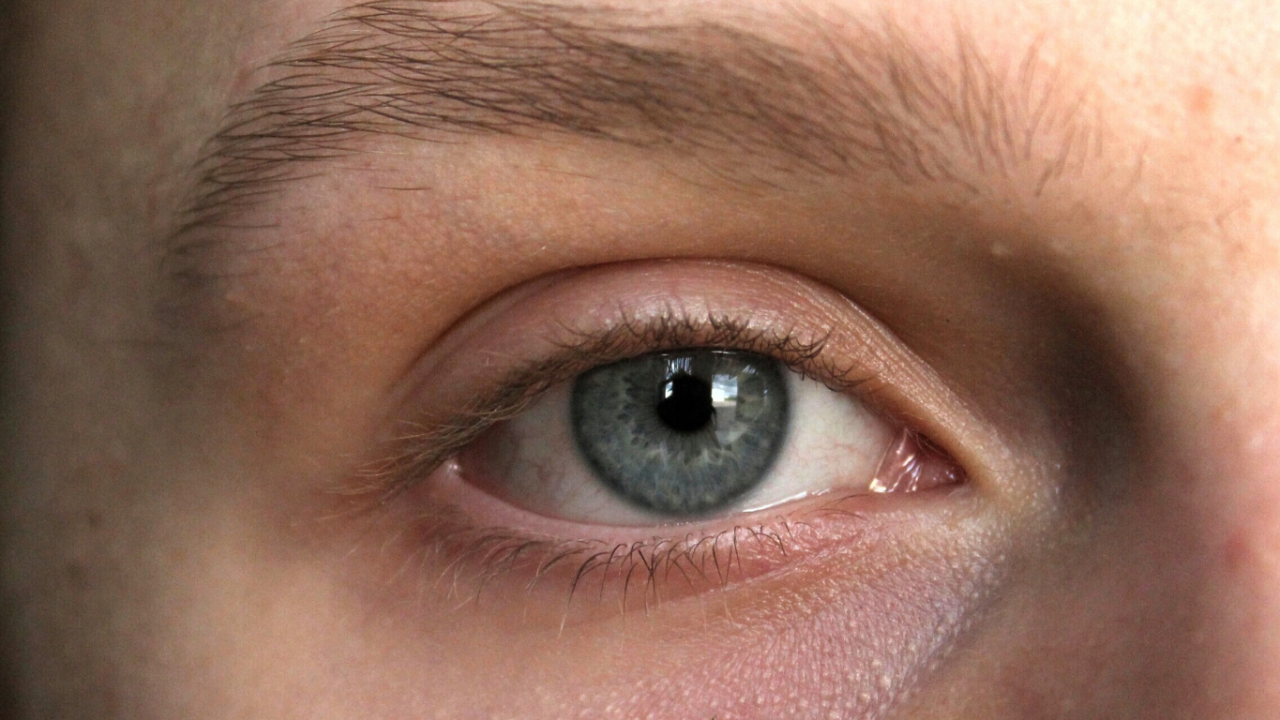 Meibomitis: que es, causas, síntomas y tratamientos claves