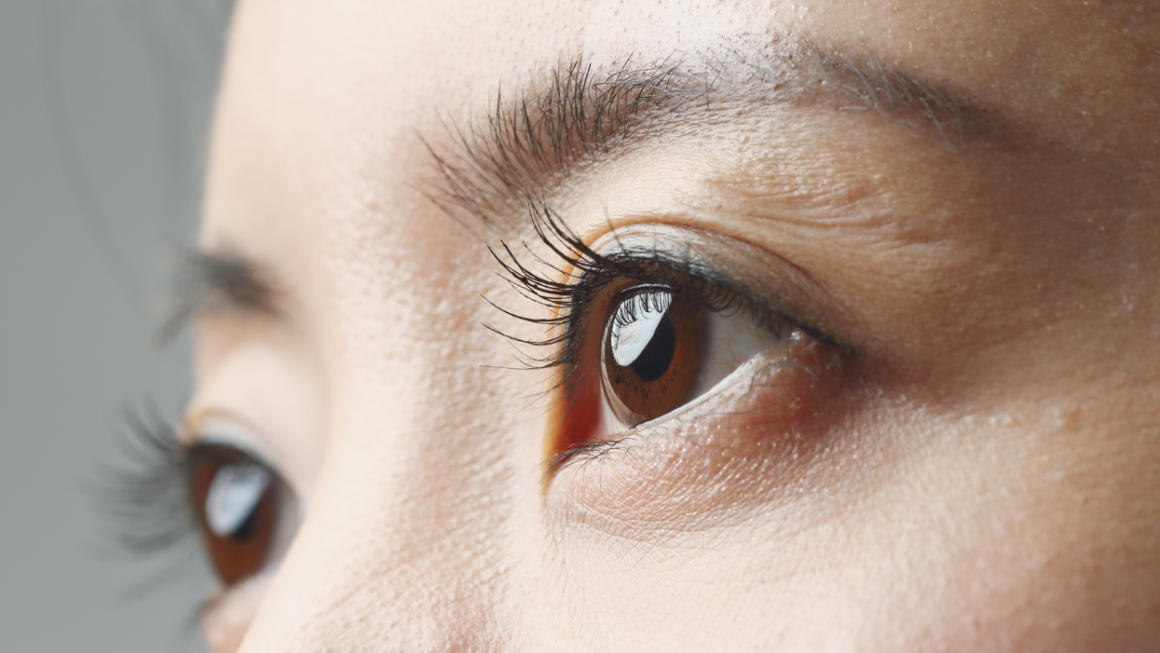 Coroiditis: síntomas, causas y tratamientos efectivos