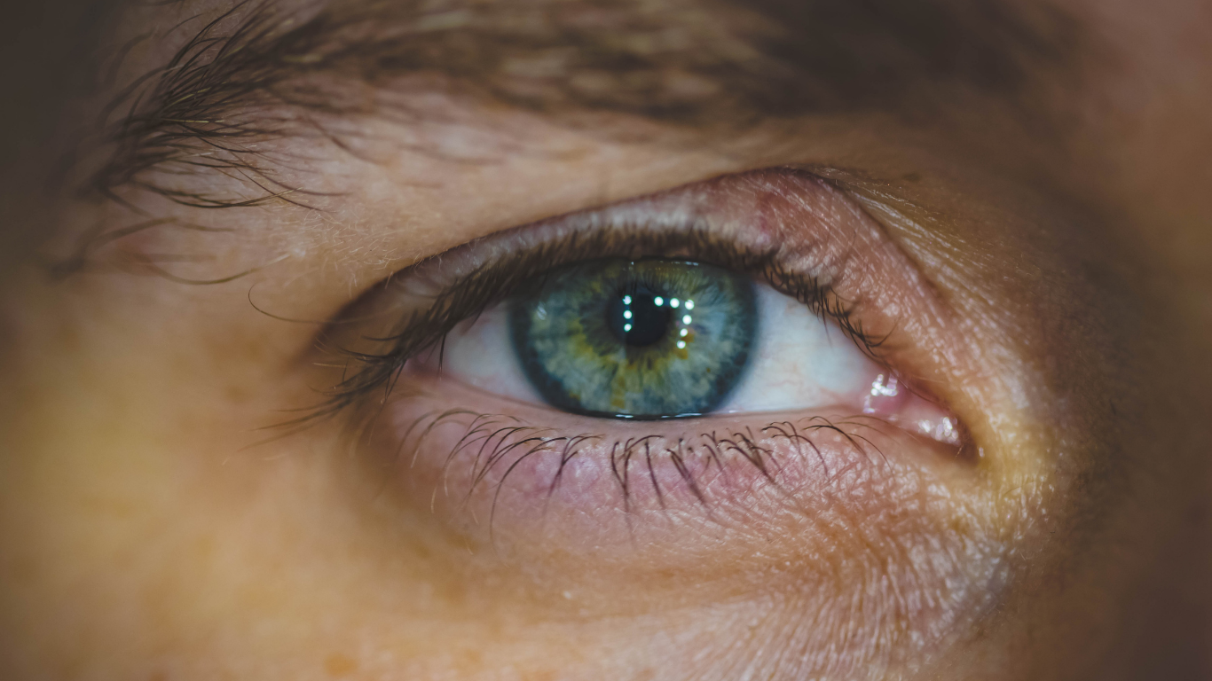 Celulitis Preseptal: guía de causas, síntomas y tratamientos