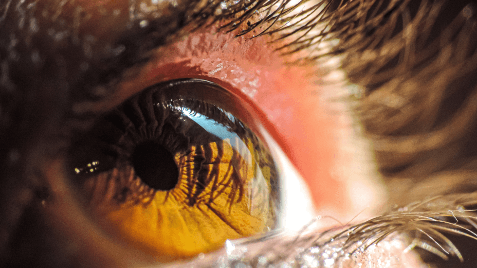 Diplopia: causas, tipos y cómo tratar la visión doble